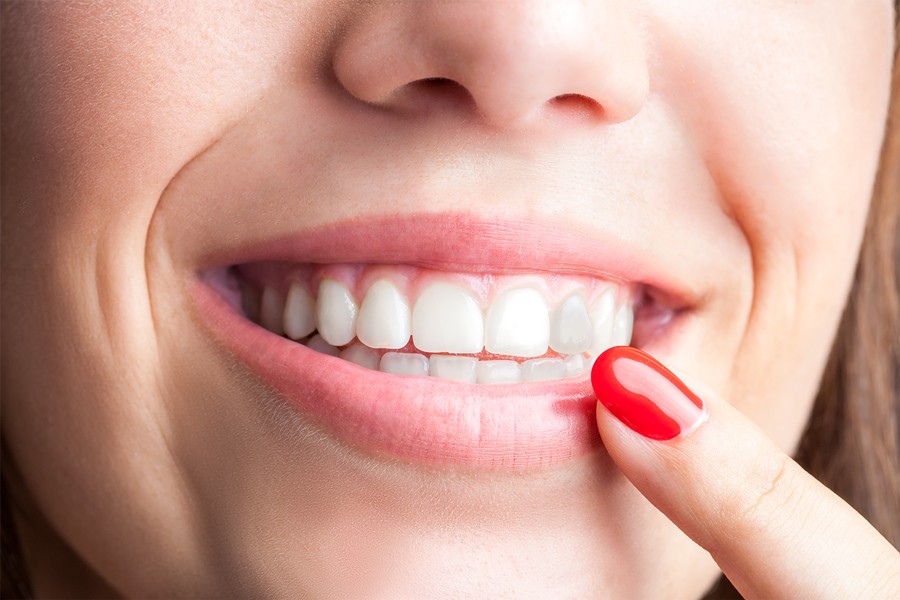 Black Teeth: Symptoms, Causes, Stains and Treatment