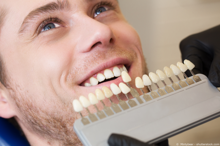 How to Choose the Right Shade for Teeth Whitening